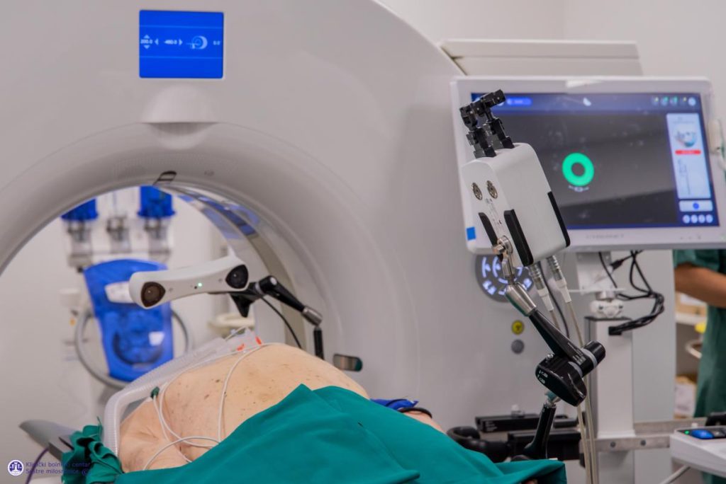 First in Croatia – tumor ablation and biopsy performed using robotic arm | Croatia Week